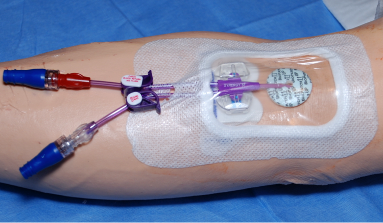 Can we change the connector? - CVC Health Care